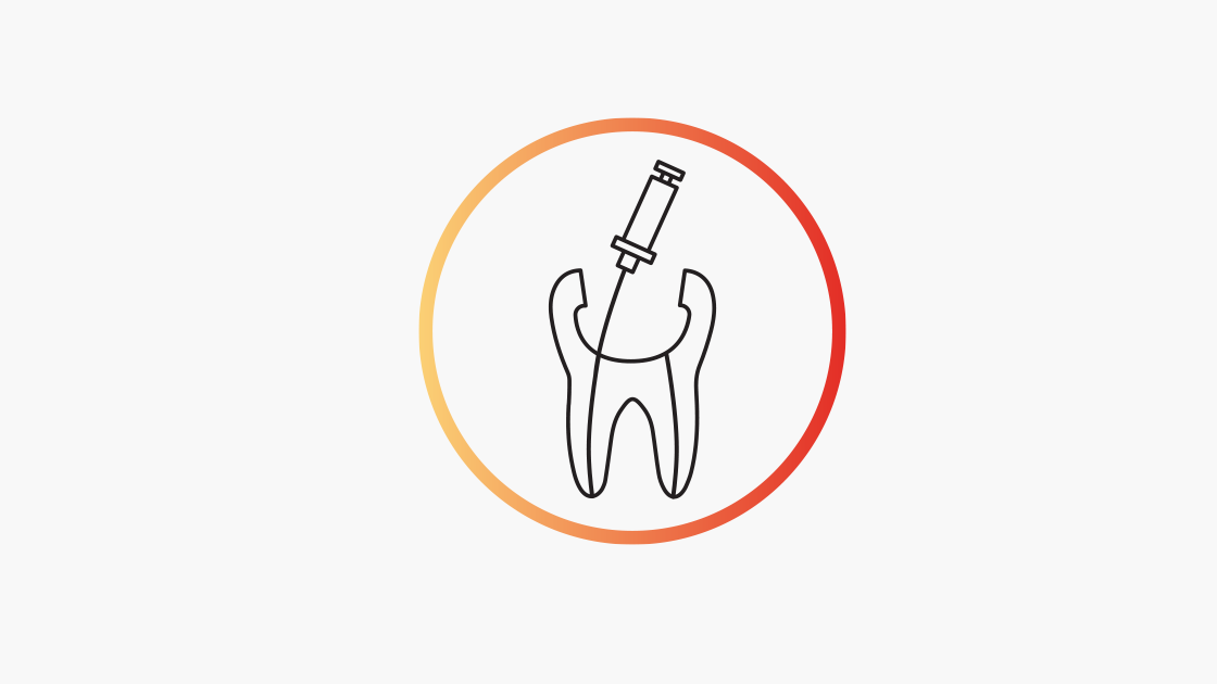 Endodontic root canal shaping | Denstply Sirona USA