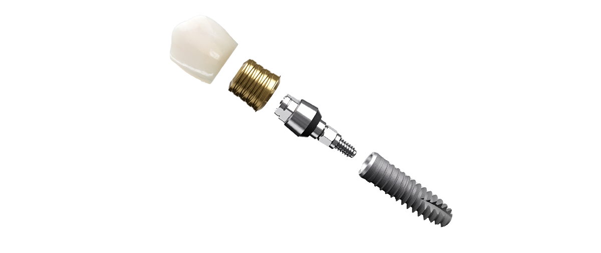 Acuris Conometric Implant Abutment | Dentsply Sirona USA