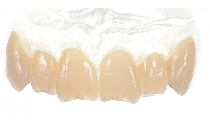 Celtra Press | Dentsply Sirona USA