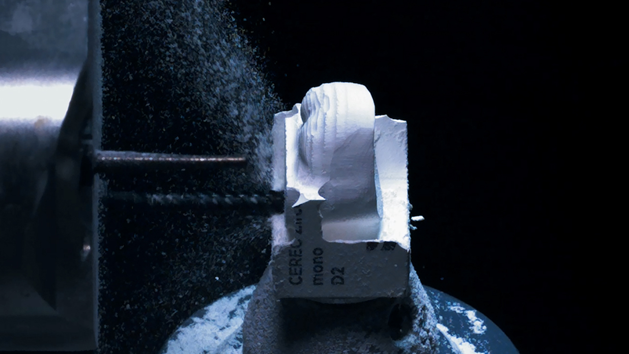 Chairside Workflow for In-Office Milled Crowns | Dentsply Sirona