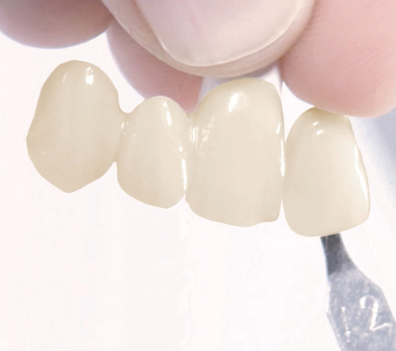 Materiales para coronas y puentes de cerámica | Dentsply Sirona Costa Rica
