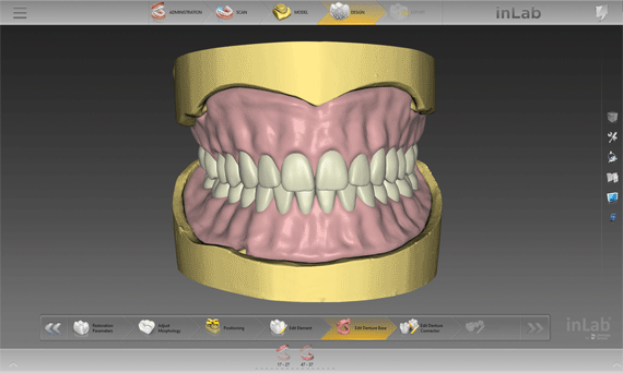 Digital dentures with inLab: Discover now! | Dentsply Sirona